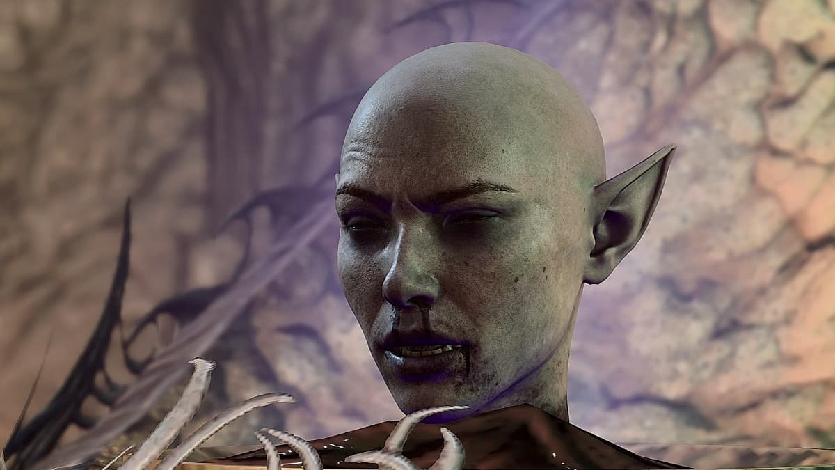 Baldur’s Gate 3: Should You Consume or Purge the Slack-Skinned Head ...